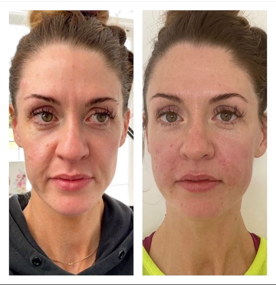 CS Medical Aesthetics and their experience using Sunekos - BF Mulholland Ltd